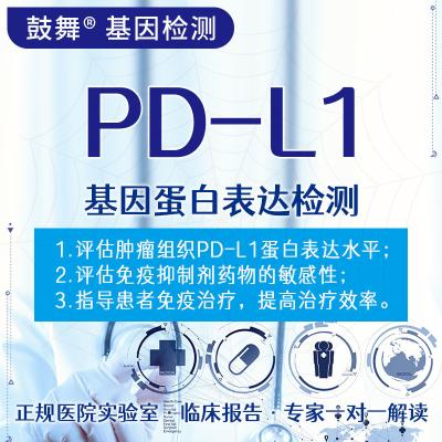 Cina Espressione del gene PD-L1 Esame genetico del sangue Quantificazione della fluorescenza PCR in vendita