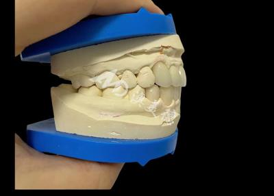 Unbeatable Strength Dental Zirconia Dentla Crown For Natural Looking Smiles