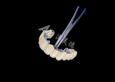Long-lasting Bonding PFM Dental Crown Bridge With Excellent Biocompatibility
