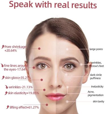 Chine Mini appareil de beauté pour les yeux, soins de la peau, massages oculaires, baguettes de beauté pour le visage, outils EMS vibrant à vendre