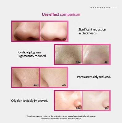 Chine Nettoyeur de pores Silicone lavage du visage brosse à éplucher Exfolier USB Charge IPX6 étanche à vendre