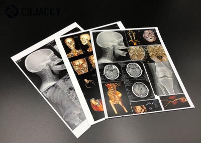Cina film di stampa medico di radiazione di 0.15mm in vendita