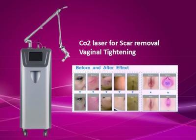 中国 アクネは取り外しのDermatological外科僅かの二酸化炭素レーザー機械を傷つけます 販売のため