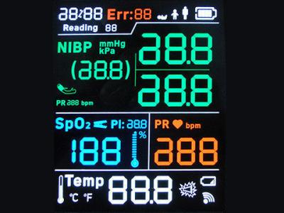 China Monocromo positivo del panel LCD FSTN 7 del segmento reflexivo del TN en venta