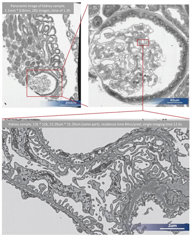 Pathological analysis example