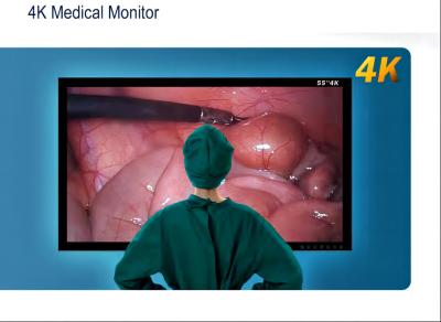 China 4K Endoscope Camera One Touch for Easy Video Recording and Quick Access to Important Information for sale
