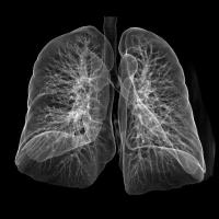 Cina Pollice impermeabile 8x10 del film asciutto medico lucido per Fuji Drypix Lite 2000 in vendita