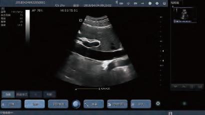 Da ponta de prova sem fio do ultrassom da ponta de prova do telefone celular ponta de prova variável Micro-convexa Transvaginal linear convexa