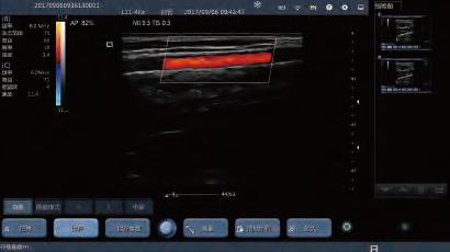Da ponta de prova sem fio do ultrassom da ponta de prova do telefone celular ponta de prova variável Micro-convexa Transvaginal linear convexa