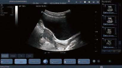 Da ponta de prova sem fio do ultrassom da ponta de prova do telefone celular ponta de prova variável Micro-convexa Transvaginal linear convexa