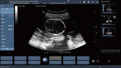 Da ponta de prova sem fio do ultrassom da ponta de prova do telefone celular ponta de prova variável Micro-convexa Transvaginal linear convexa