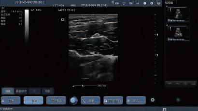 Da ponta de prova sem fio do ultrassom da ponta de prova do telefone celular ponta de prova variável Micro-convexa Transvaginal linear convexa