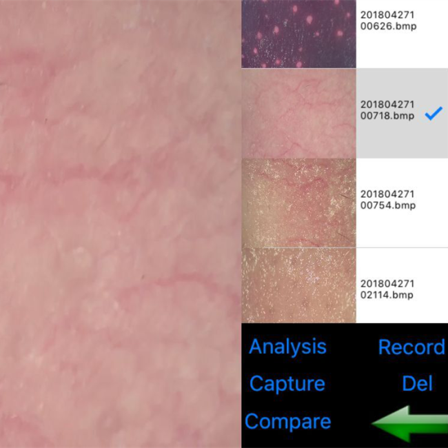 Analizzatore facciale tenuto in mano del cuoio capelluto di Wifi dell'analizzatore dell'umidità e dell'olio della pelle di Dermatoscope