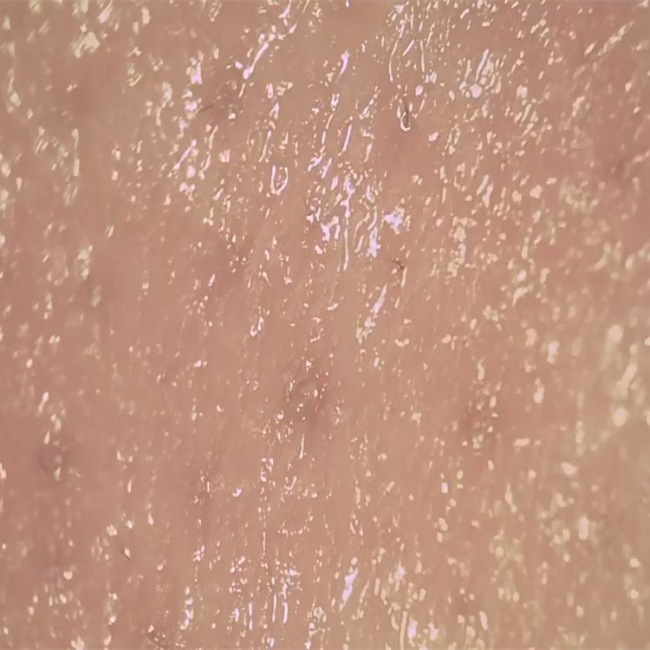 Analizzatore facciale tenuto in mano del cuoio capelluto di Wifi dell'analizzatore dell'umidità e dell'olio della pelle di Dermatoscope