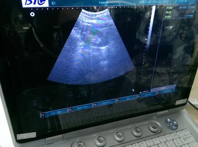 중국 3D 디지털 방식으로 B/W 볼록한 선형 Transvaginal 조사를 가진 휴대용 초음파 스캐너 판매용