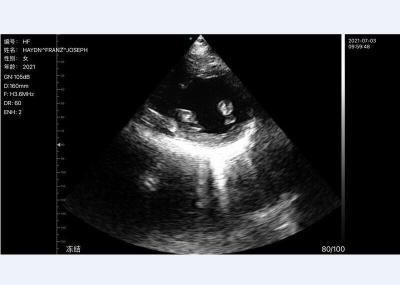 China Persönlicher Ultraschallscanner Linear+Herzsonde 2,2 MHz Mobiles DICOM-Format zu verkaufen