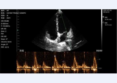 China Persönlicher Ultraschallscanner Linear+Herzsonde 2,2 MHz Mobiles DICOM-Format zu verkaufen