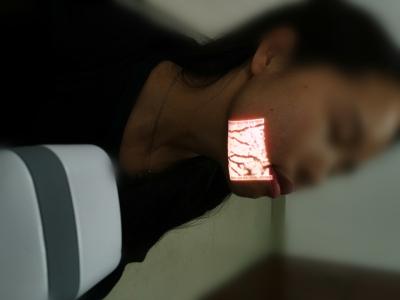 中国 静脈のために「緑か黒いより明確な静脈を表示するための Infared ライト Transilluminator の静脈のファインダーの近く s 色 販売のため