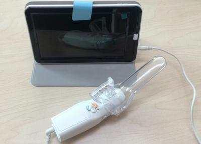 Κίνα AV/συνδεδεμένη USB πλήρης ψηφιακή κάμερα Colposcope κόλπων HD με την μπαταρία Αντιαεροπορικού Πυροβολικού προς πώληση