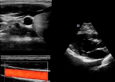 China Color Doppler Ultrasound Probe Handheld Ultrasound Device For Mobilephone / PC for sale
