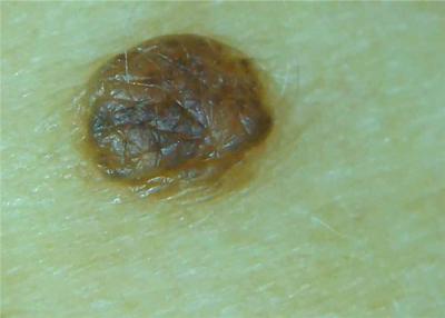 중국 인조 인간과 IOS 소프트웨어를 위한 무선 디지털 방식으로 현미경 Dermatoscope 피부와 머리 스캐너 판매용
