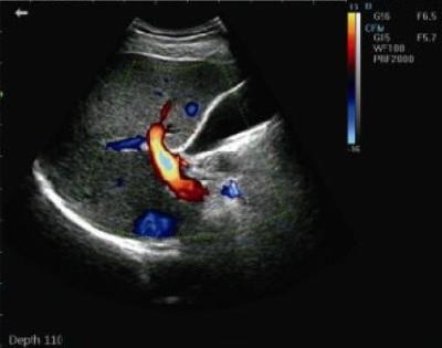 Κίνα Πλήρες ψηφιακό χρώματος Doppler μηχανών συστημάτων καροτσάκι ανιχνευτών υπερήχου γωνίας διευθετήσιμο προαιρετικό προς πώληση