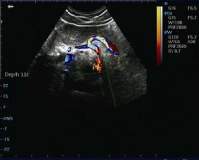 Κίνα Πλήρες ψηφιακό χρώματος Doppler μηχανών συστημάτων καροτσάκι ανιχνευτών υπερήχου γωνίας διευθετήσιμο προαιρετικό προς πώληση