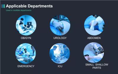 중국 USB 휴대용 초음파 스캐너 볼록한/선형 조사는 안드로이드 Windows를 지원했습니다 판매용
