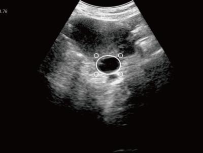 중국 USB 휴대용 초음파 스캐너 볼록한/선형 조사는 안드로이드 Windows를 지원했습니다 판매용