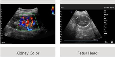 중국 디지털 방식으로 똑똑한 소형 초음파 스캐너 빵꾸 지도를 위한 무선 초음파 조사 판매용
