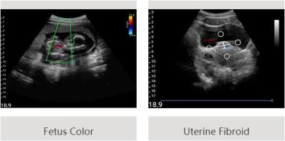 중국 디지털 방식으로 똑똑한 소형 초음파 스캐너 빵꾸 지도를 위한 무선 초음파 조사 판매용