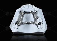 Quality High Strength 3D Printed Titanium Framework With Clear Clasps For Durable Performance for sale