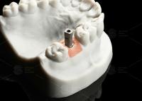 Quality Precision Titanium Digital Implant Scan Body Sandblasted Surface For Cad/Cam for sale