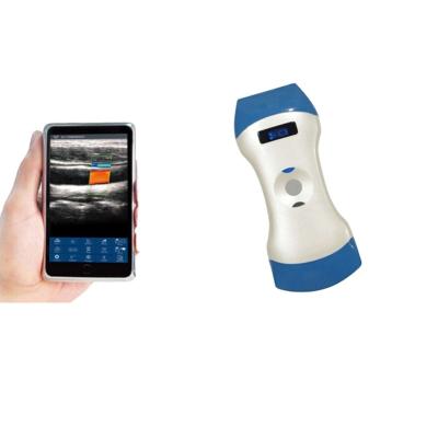 Cina Handheld Wireless Mini B Color Doppler Ultrasound Probe in vendita