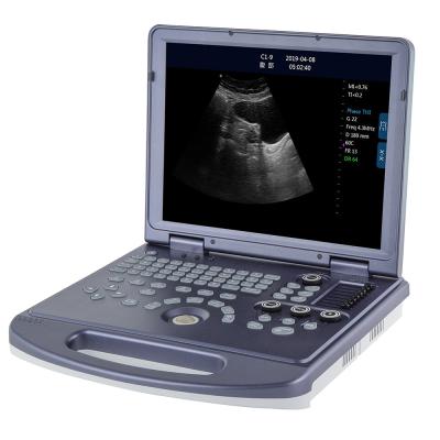 Cina Medical Ultrasound Machine SuppliersB&W Ultrasound 15.6-inch LCD medical monitor with high resolution and 180-degree open angle in vendita