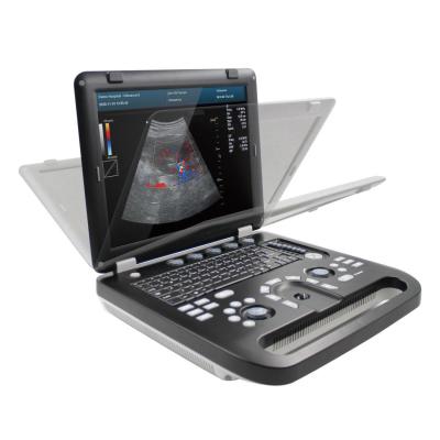 Китай High Quality Ultrasound Scanner 3D 4D 5D Portable Color Doppler Ultrasonic Diagnostic System продается
