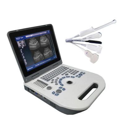 Китай Black and White Ultrasound Diagnostic Equipment Fibroscan Portable Full Digital Ultra sound Scanner продается