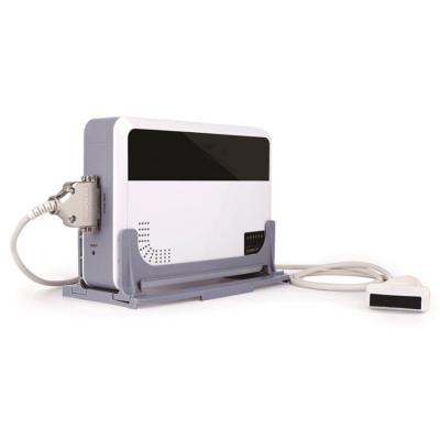 Китай CE ISO Approved Medical Diagnostic Equipment Portable Ultrasound Bone Scan Densitometer Machine DEXA продается