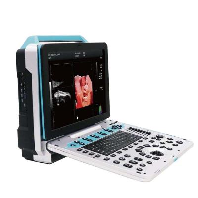 Китай Portable Ultrasound Pregnancy Monitoring Devices 15 Inches High Definition продается