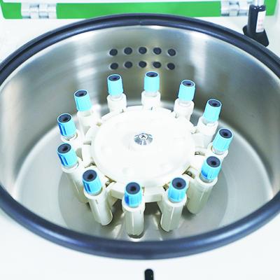 China HLA Examinations And Red Blood Cell Cleaning Washer Centrifuge ISO Certified for sale