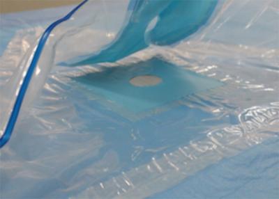 Κίνα Γονάτων Arthroscopy ρευστή συλλογής υποστήριξη Drape τσαντών μίας χρήσης αποστειρωμένη χειρουργική προς πώληση