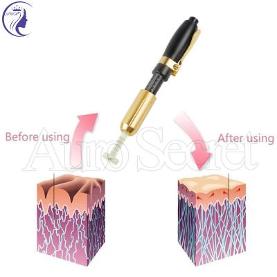 중국 최고의 가격 한국 프로페셔널 골드 블랙 0.3ml&0.5ml 히알루론산 더말 필러 앰플 판매용