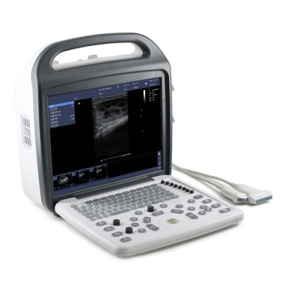 중국 GHDCU10은 가득 찬 디지털 컬러 도플러 GYN 수의 진단용 초음파를 점검합니다 판매용