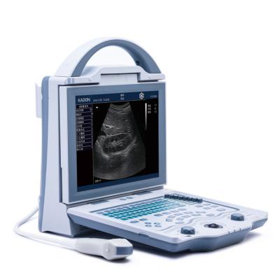 중국 증상을 나타내는 의료 초음파 기계 KX5600 초음파 기계 가득 찬 디지털 비 방식 판매용