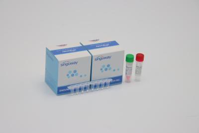 Cina CE fluorescente quantitativo di tempo reale del corredo POCT di rilevazione di PCR del virus di HIV in vendita