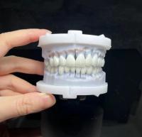 Quality Natural Porcelain Fused To Zirconia Translucent PFZ Bridge And Crown for sale