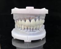 Quality Aesthetic PFZ Crown Zirconia Bridge Durable High Strength PFZ Bridge for sale