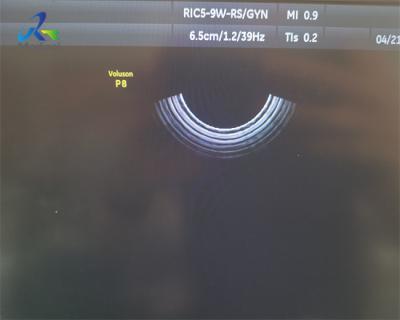 China O reparo 4D da ponta de prova do ultrassom de GE RIC5-9W-RS substitui o enchimento da abóbada e do óleo à venda