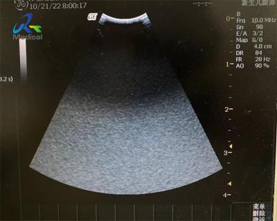 China Substituição acústica da lente do serviço de reparações da ponta de prova do ultrassom de GE 8C-RS à venda