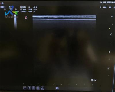 中国 Biosound Biosound SL1543 リニアアレイ超音波プローブ修理レンズとクリスタルを交換 販売のため